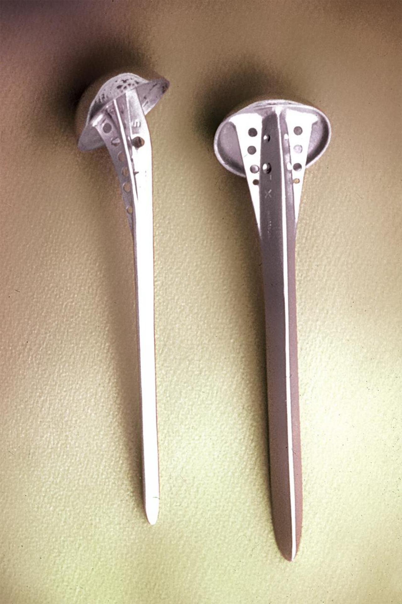 Orthopedics History at Columbia | Columbia Orthopedic Surgery