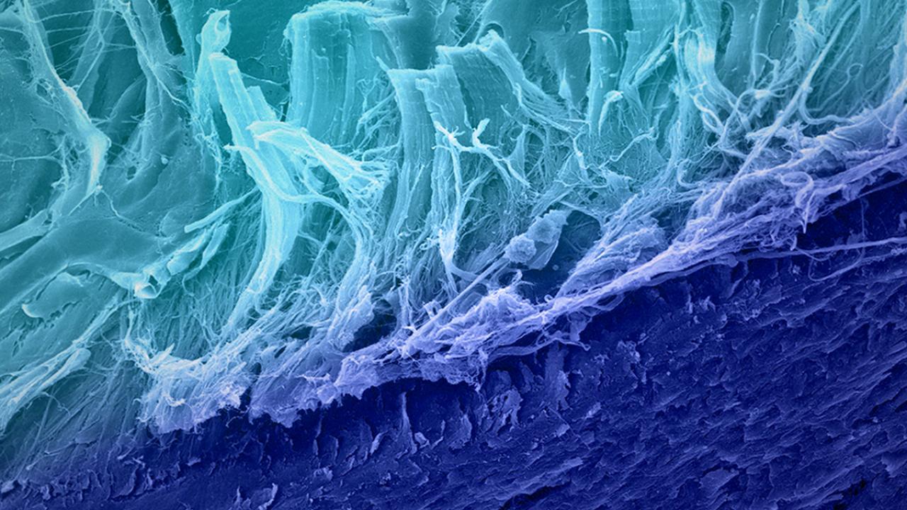 Thomopoulos Lab | Columbia Orthopedic Surgery