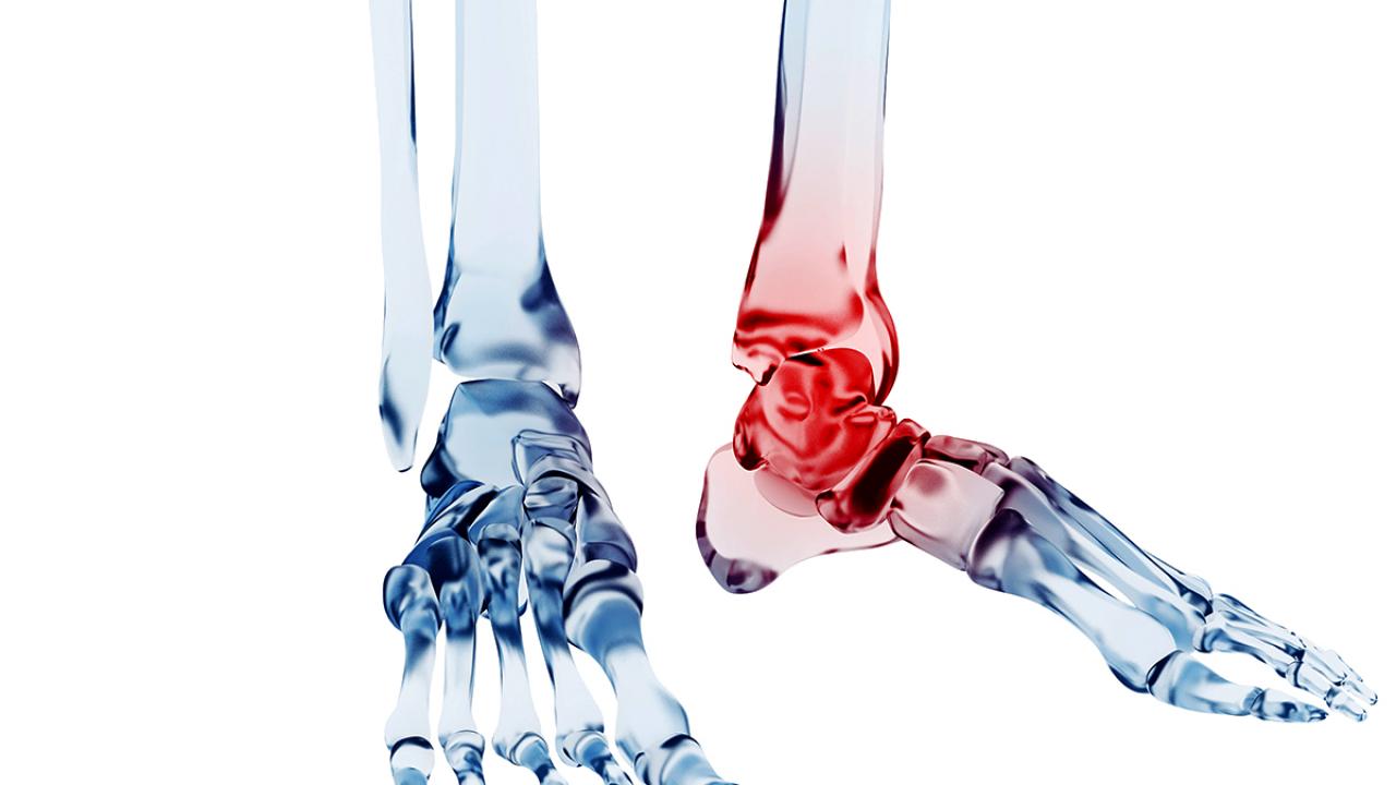 Conditions & Treatments | Columbia Orthopedic Surgery