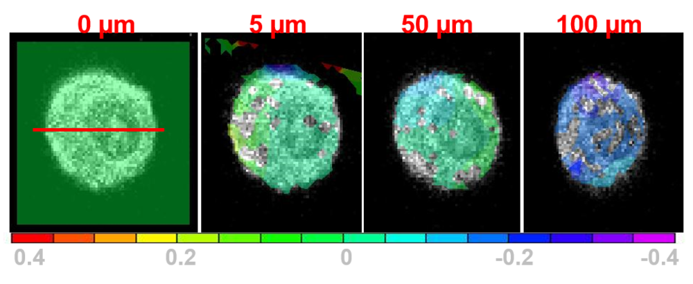 Disc Cell Mechanobiology and Disease | Columbia Orthopedic Surgery
