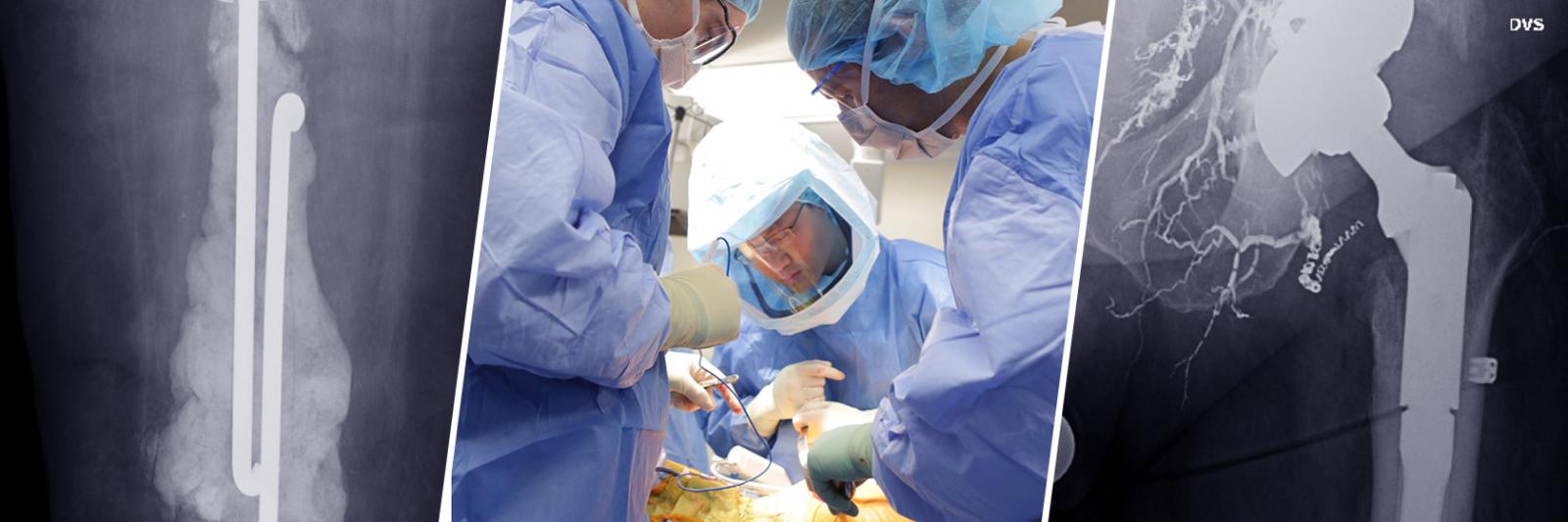Frank E. Stinchfield Adult Reconstruction Fellowship | Columbia ...