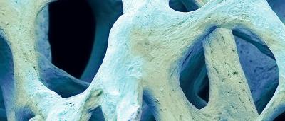 Growing Rods | Columbia Orthopedic Surgery