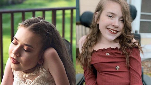 Benjamin D. Roye, MD | Columbia Orthopedic Surgery